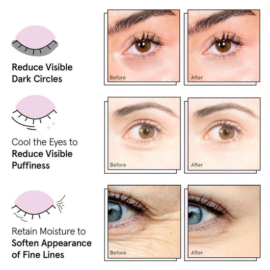 under eye masks for puffiness and wrinkles by grace and stella – grace ...