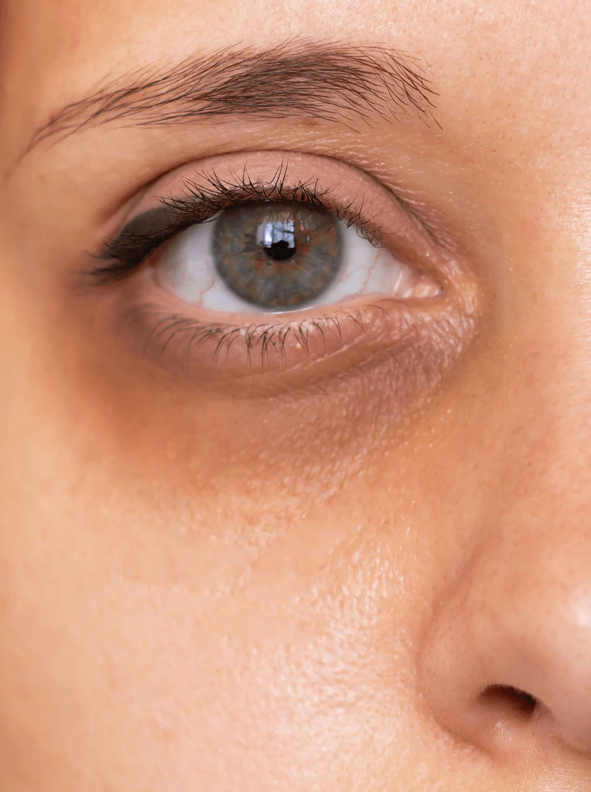 Purple Retinol Eye Masks – Grace & Stella’s Cooling + Firming Eye Treatment