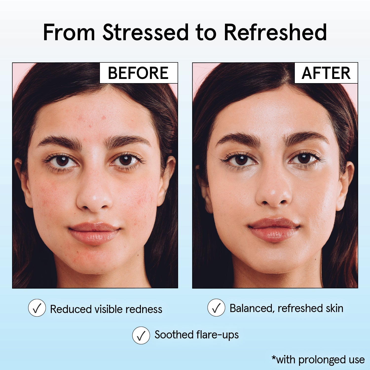 hypochlorous acid face spray for acne & redness by grace & stella