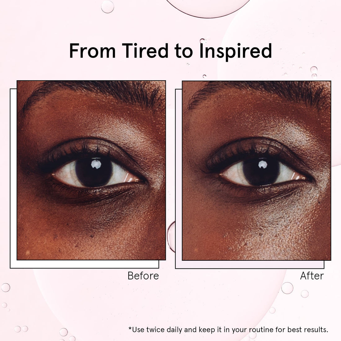 cooling caffeine eye serum roller for puffy eyes by grace & stella