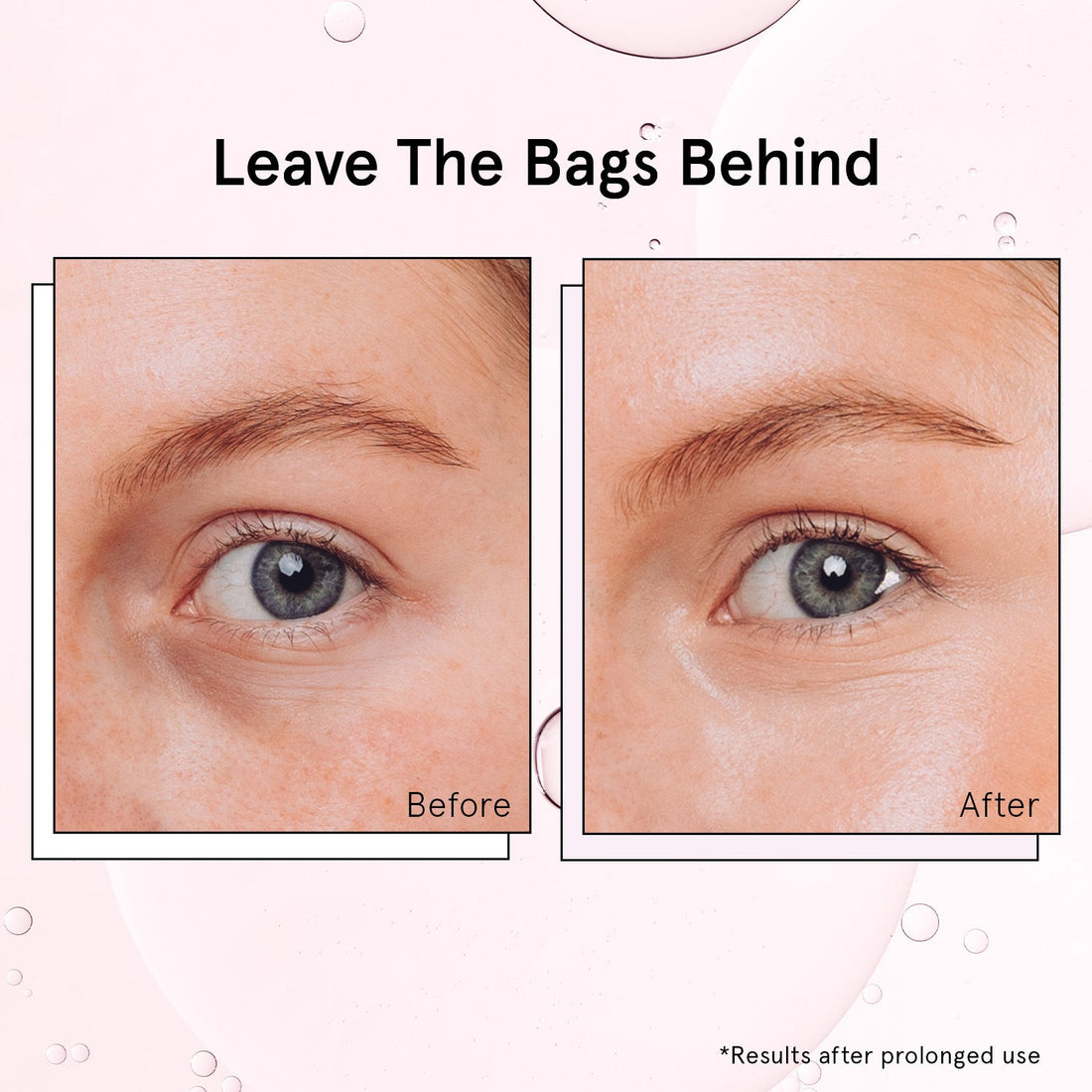 best under eye serum roller by grace & stella