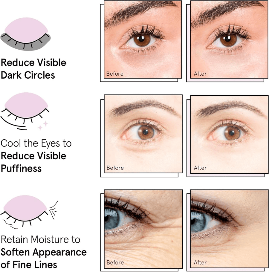 blue under eye patches for dark circles by grace & stella